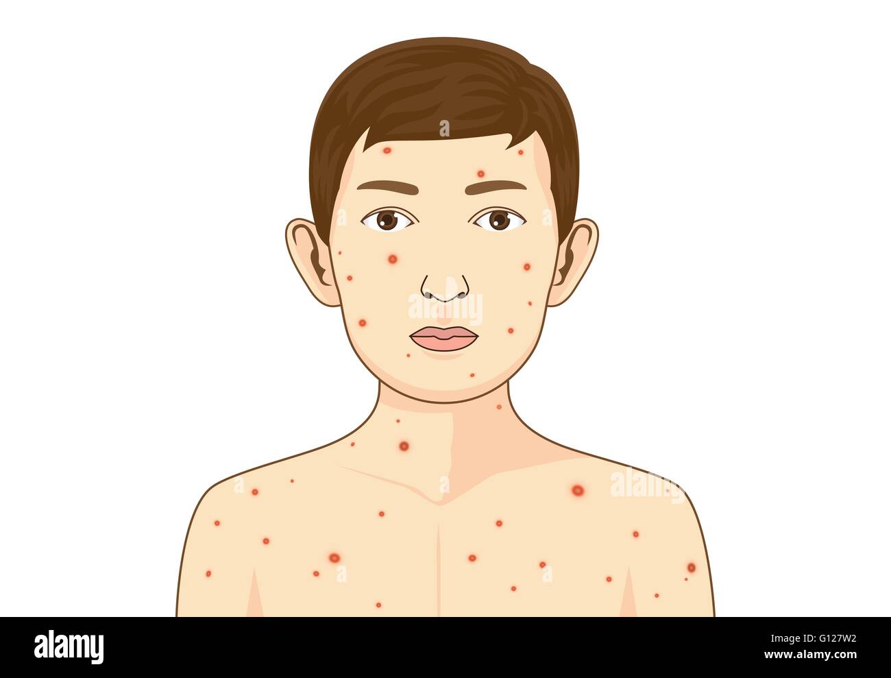 Schmerzhafte kindheit Stock-Vektorgrafiken kaufen - Alamy