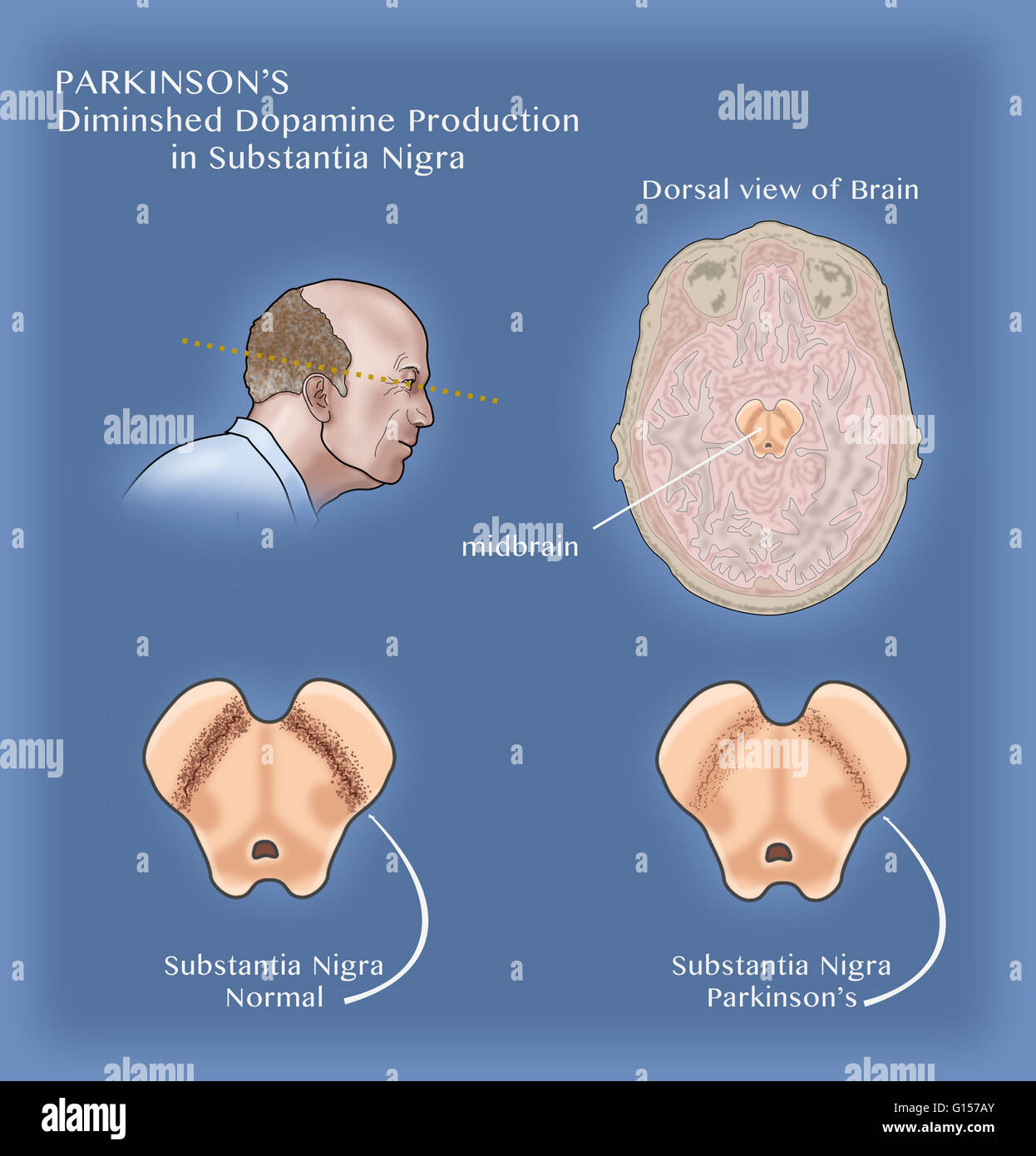 Substantia nigra -Fotos und -Bildmaterial in hoher Auflösung – Alamy