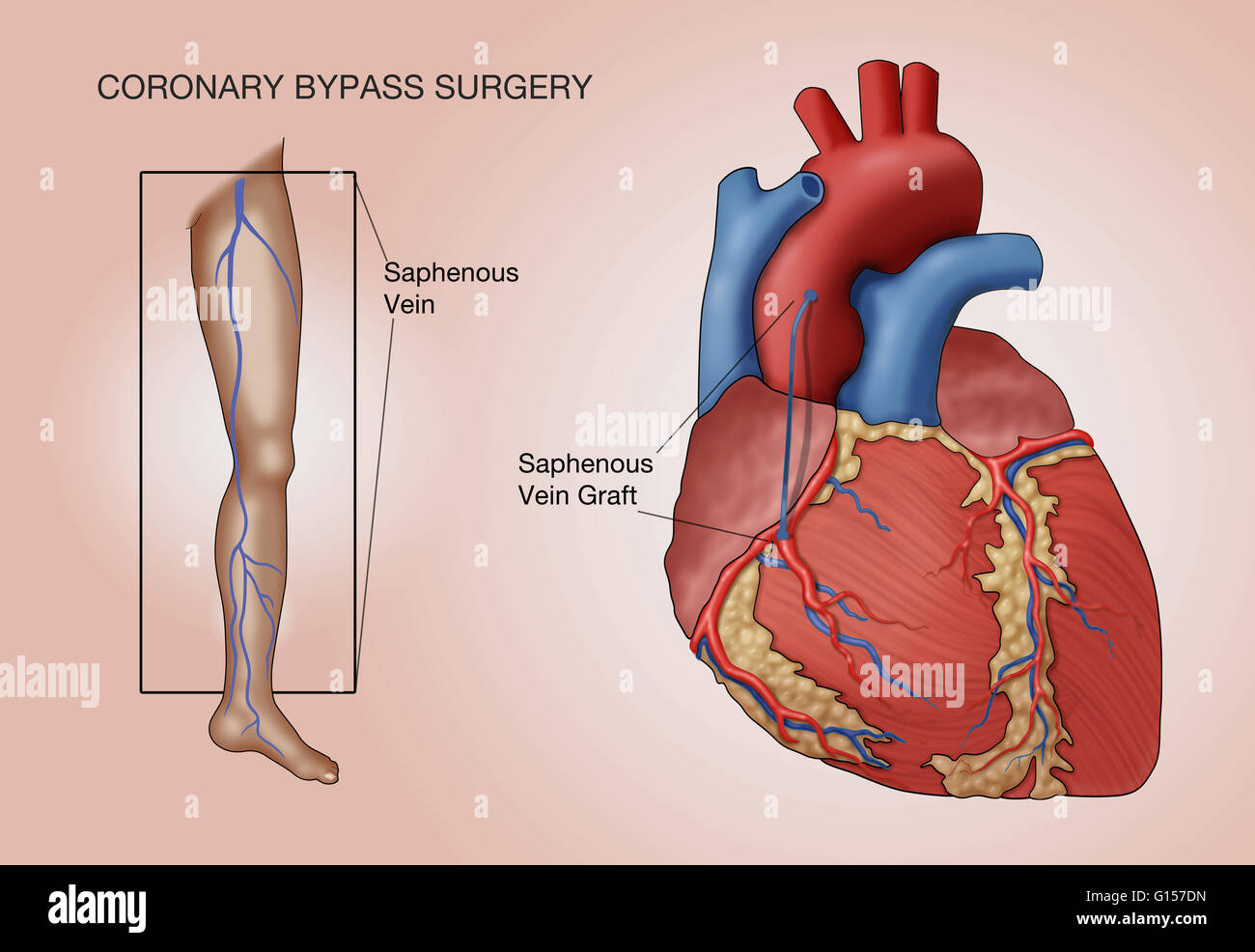 Bilder Av Enkeltroser