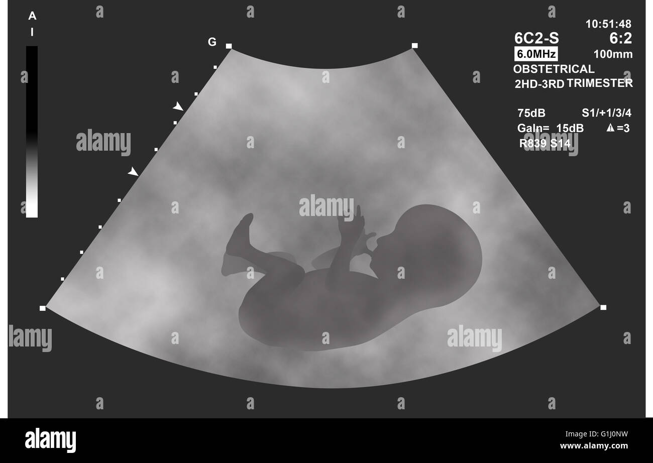 Human embryo ultrasound -Fotos und -Bildmaterial in hoher Auflösung – Alamy
