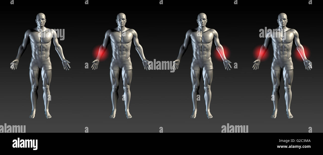Anatomie des unterarms -Fotos und -Bildmaterial in hoher Auflösung – Alamy