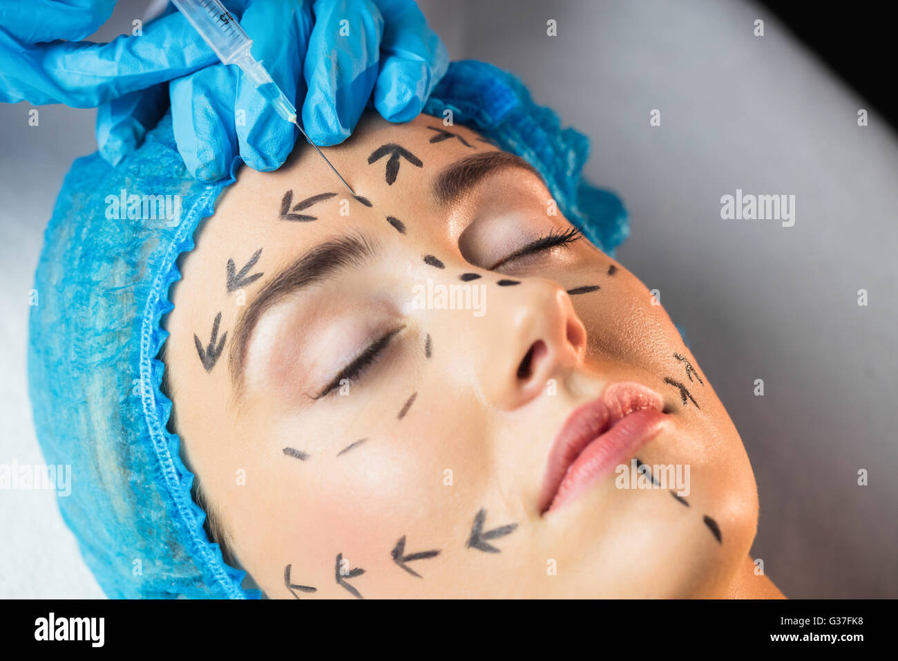 Inyección de botox con línea de jeringa -Fotos und -Bildmaterial in ...