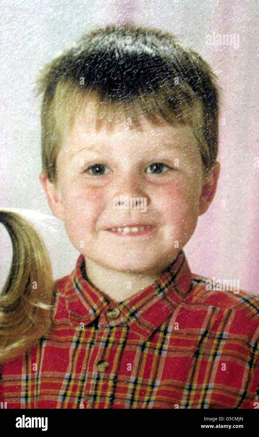 Nachdem er mit einer luftpistole in den kopf geschossen wurde -Fotos ...
