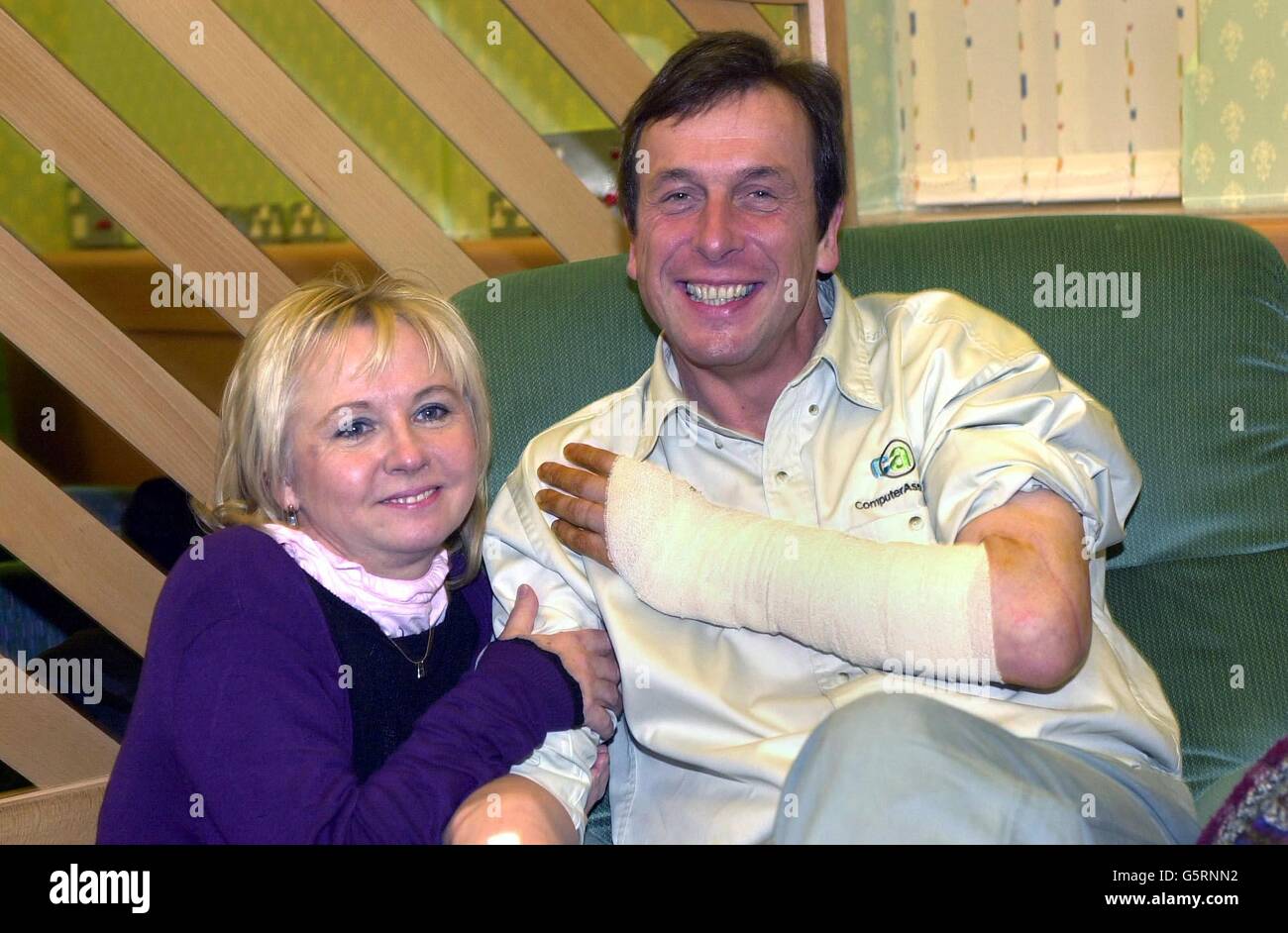 The Worlds First Cyborg Part Human Stockfotos und -bilder Kaufen - Alamy