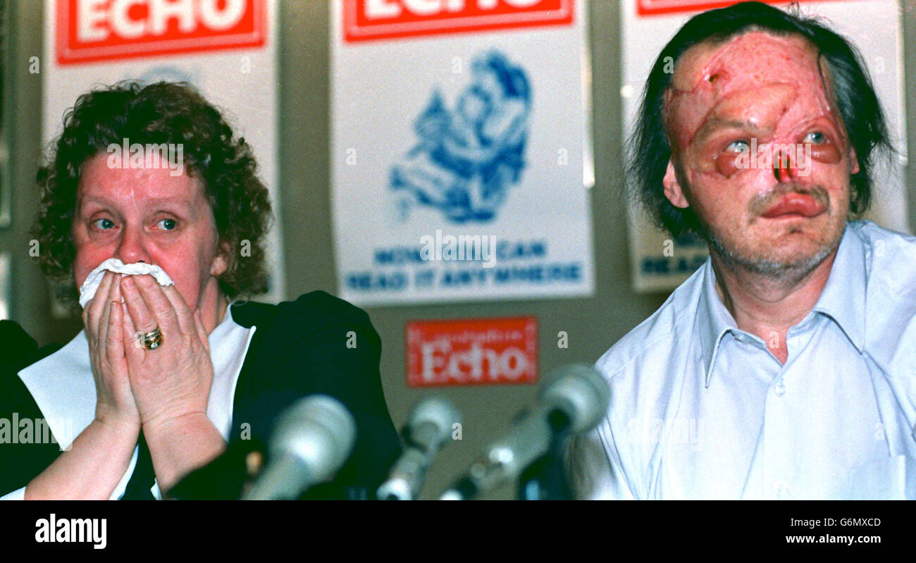 Frank sturm von zwei pitbulls angegriffen -Fotos und -Bildmaterial in ...