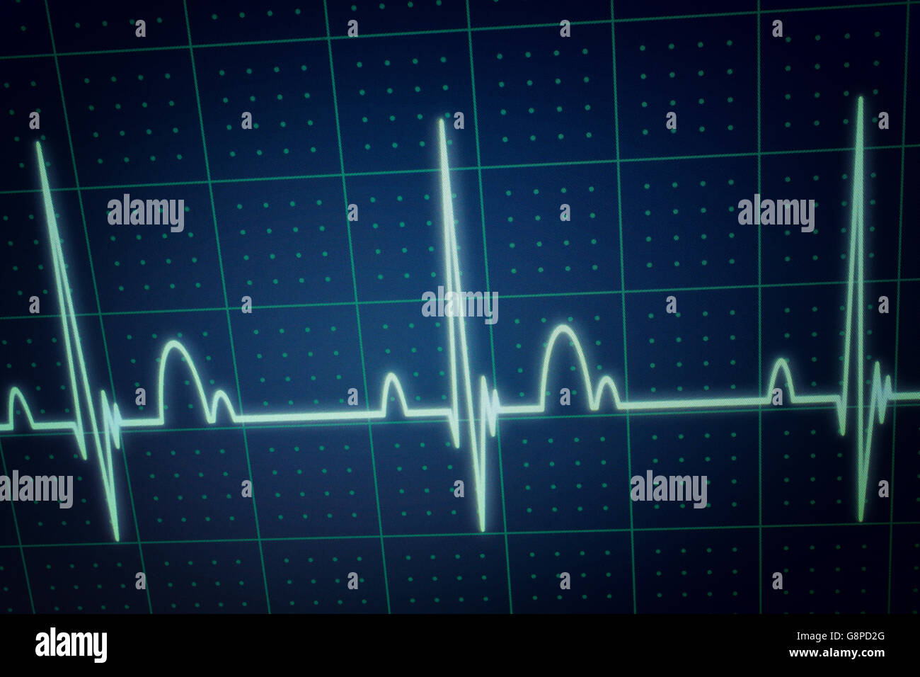 Ekg linie -Fotos und -Bildmaterial in hoher Auflösung – Alamy