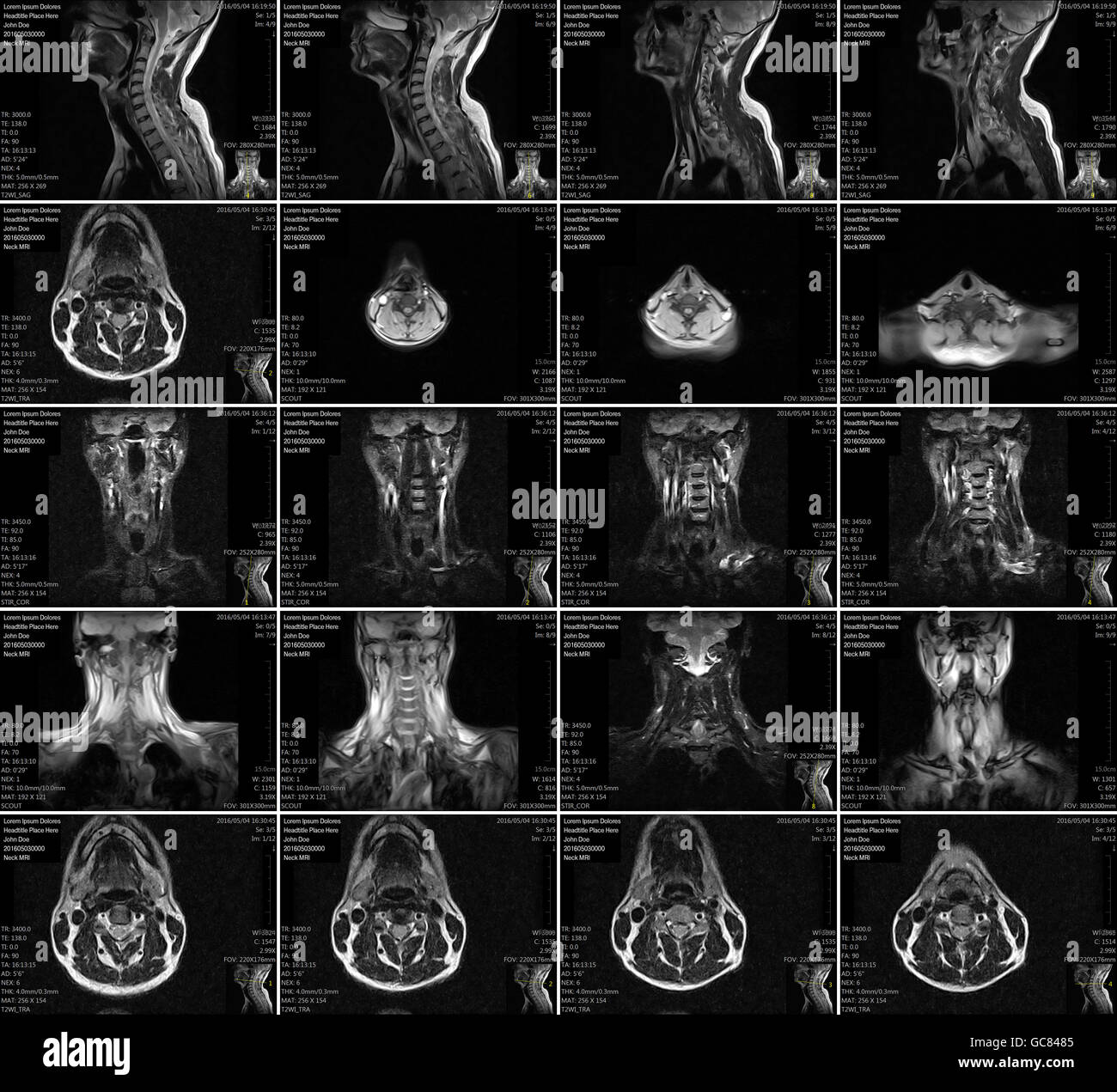 Hals mri Stockfotos und -bilder Kaufen - Alamy
