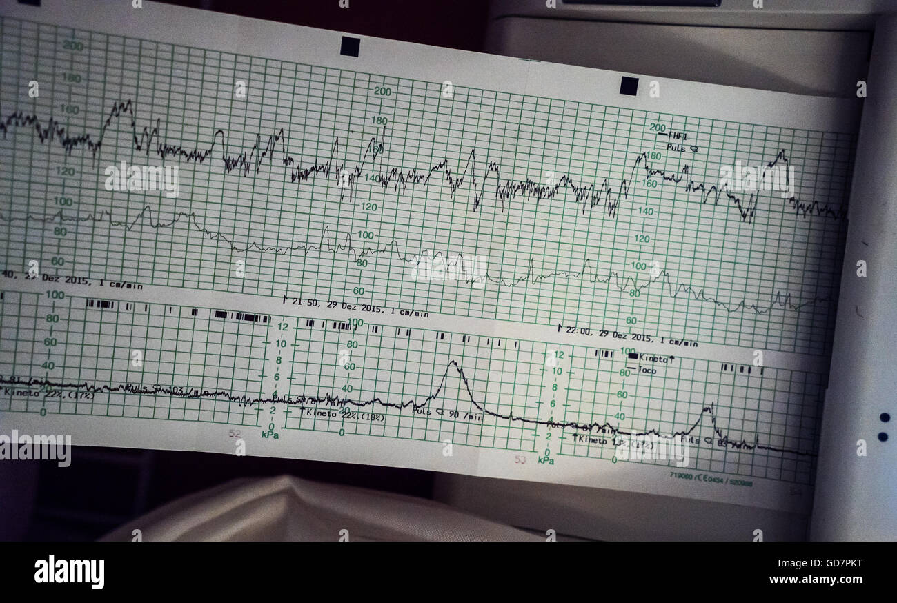 Kardiotokographie kardiotokographie untersuchung -Fotos und ...