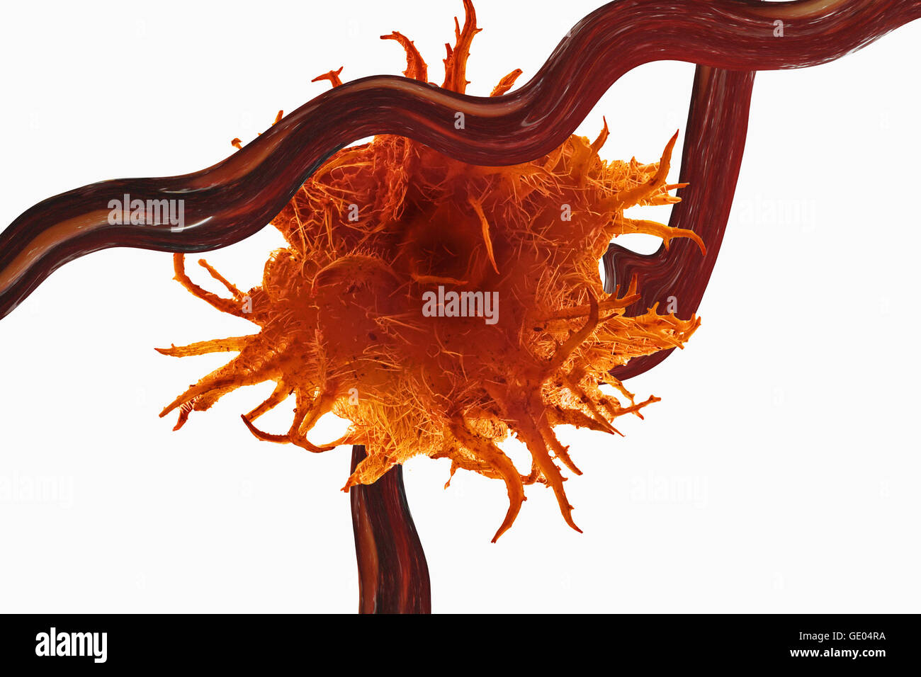 Cancerous tumor -Fotos und -Bildmaterial in hoher Auflösung – Alamy