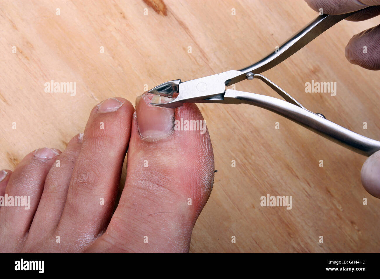 Eklige hässliche füße -Fotos und -Bildmaterial in hoher Auflösung – Alamy