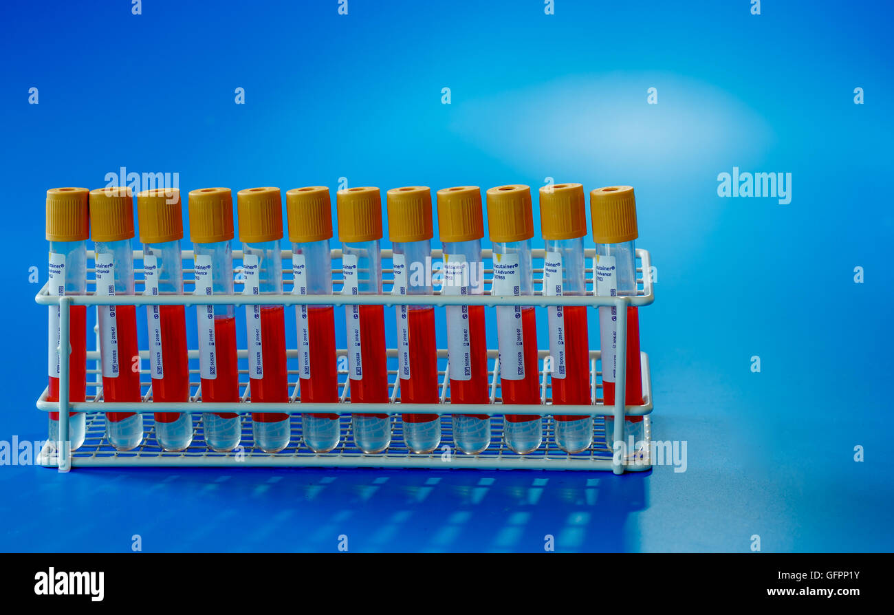 Bd vacutainer tubes -Fotos und -Bildmaterial in hoher Auflösung – Alamy