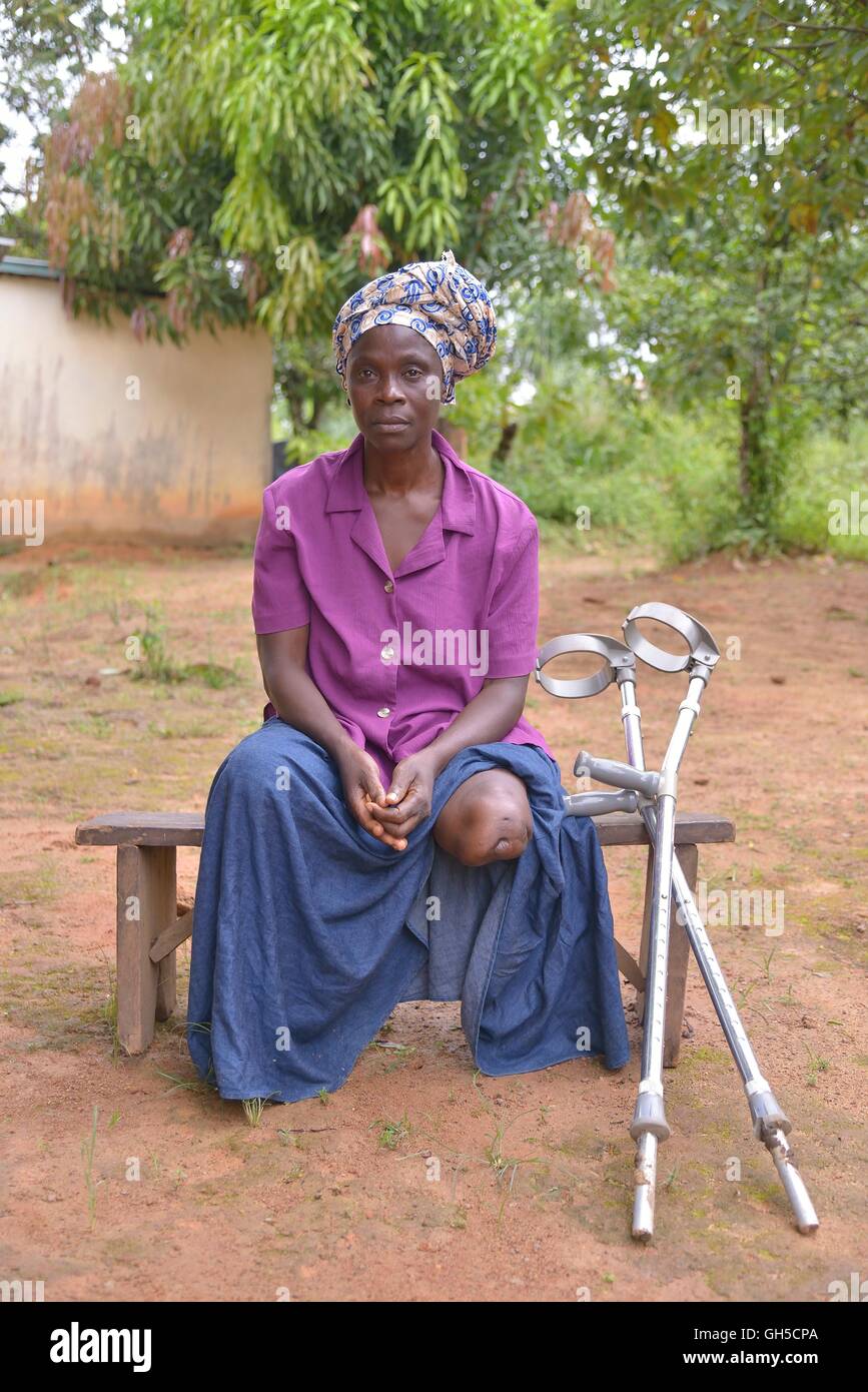 Geographie/Reisen, Sierra Leone, Sia Lebbie, amputieren, Motema Amputee ...