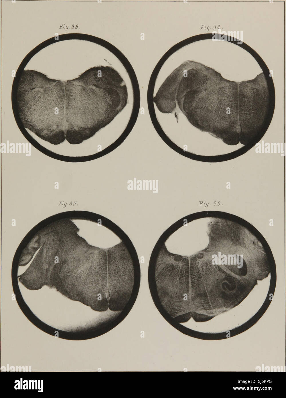 Die graue Substanz der Medulla Oblongata und Trapez (1864 ...