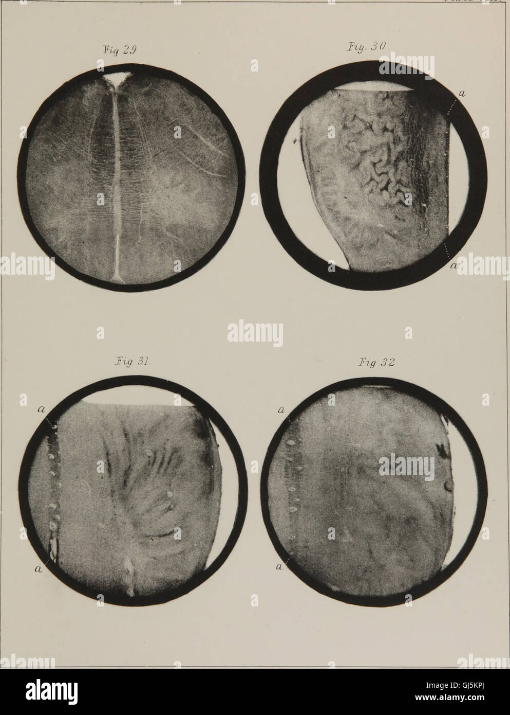 Medulla oblongata -Fotos und -Bildmaterial in hoher Auflösung – Alamy
