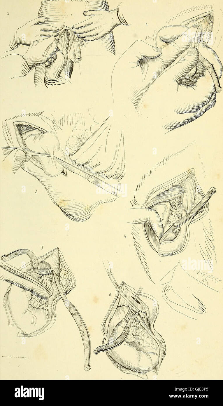 In dieser Ausgabe von „Operational Surgery Illustrated“ aus dem Jahr ...