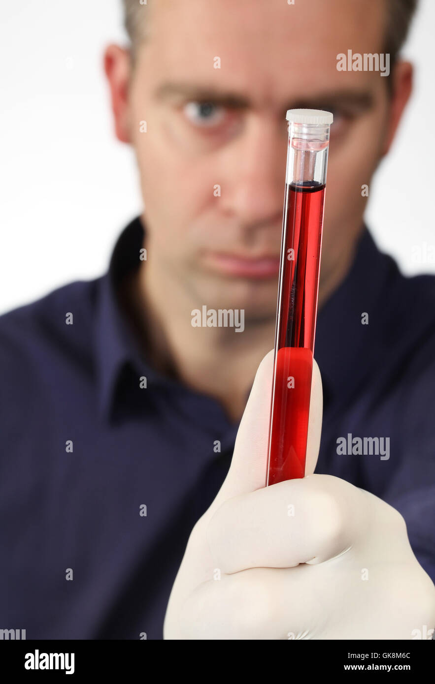 Blood analysis -Fotos und -Bildmaterial in hoher Auflösung – Alamy