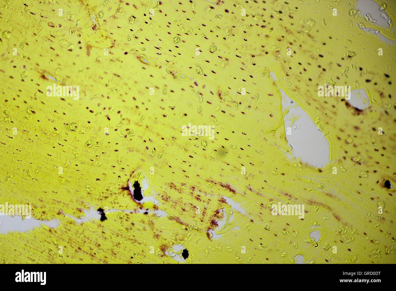 Menschliche Knochen unter Mikroskop Stockfotografie - Alamy
