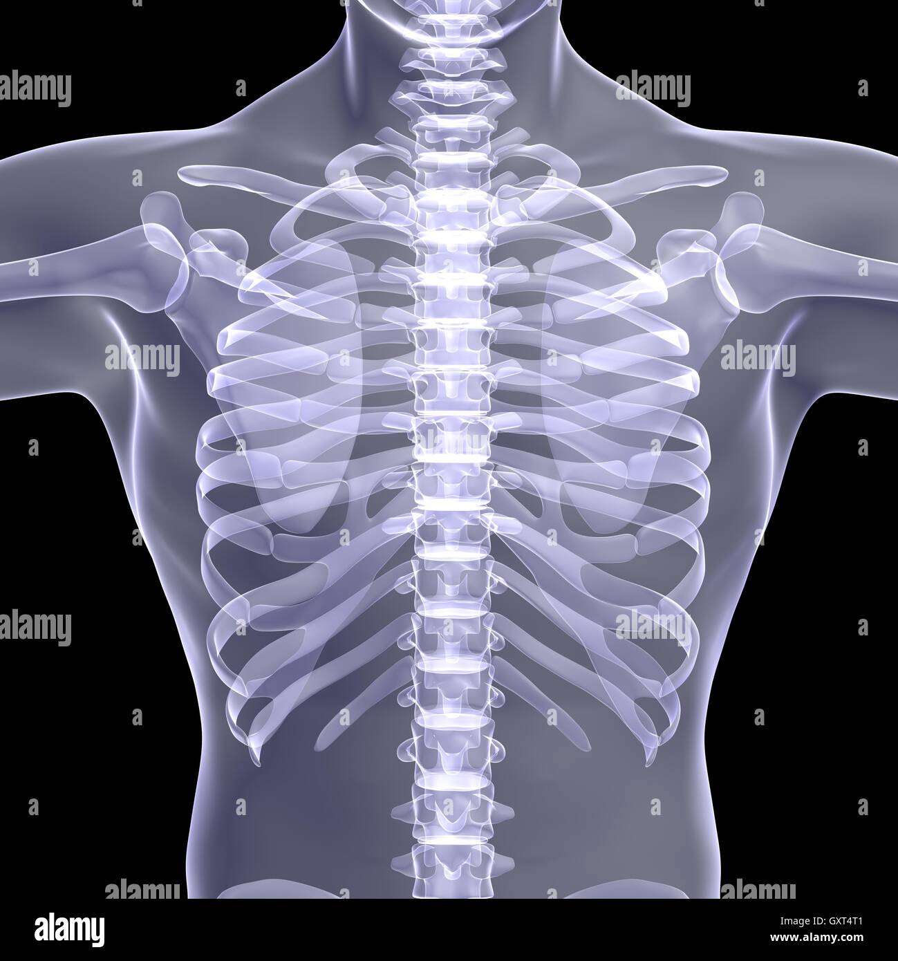 Thorax radiographie -Fotos und -Bildmaterial in hoher Auflösung – Alamy