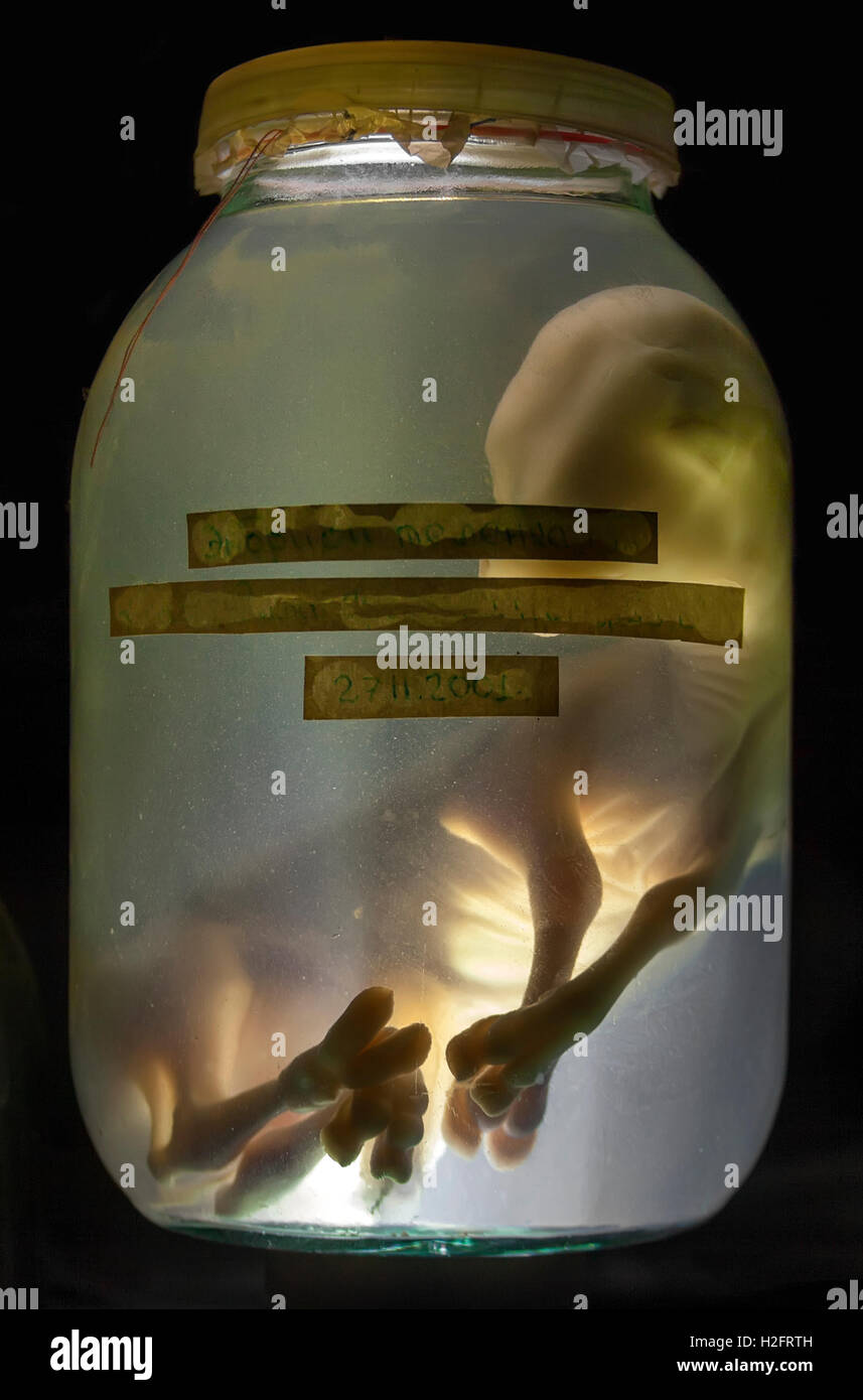 Formaldehyde jar -Fotos und -Bildmaterial in hoher Auflösung – Alamy