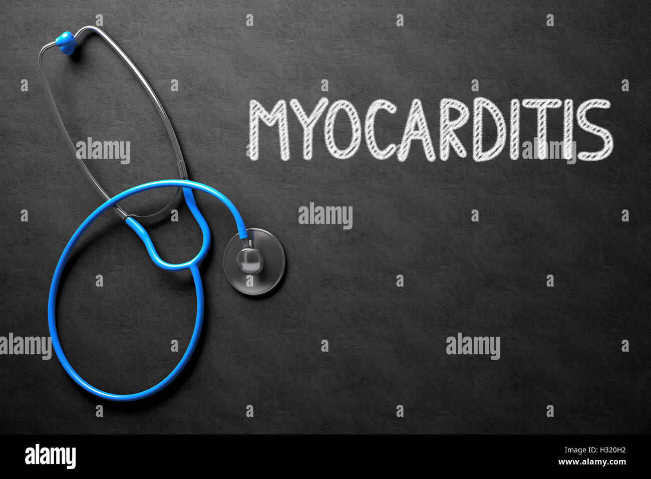 Myokarditis -Fotos und -Bildmaterial in hoher Auflösung – Alamy