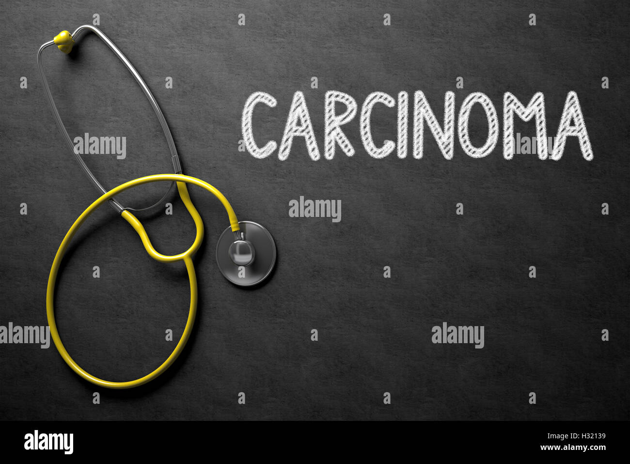Karzinom und metastasierung -Fotos und -Bildmaterial in hoher Auflösung ...
