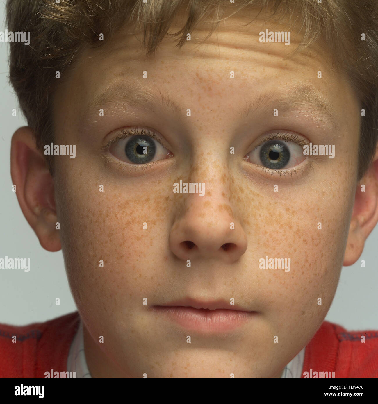 Junge, ängstlich, Sommersprossen, Stirn, Falten, Portrait, Model ...