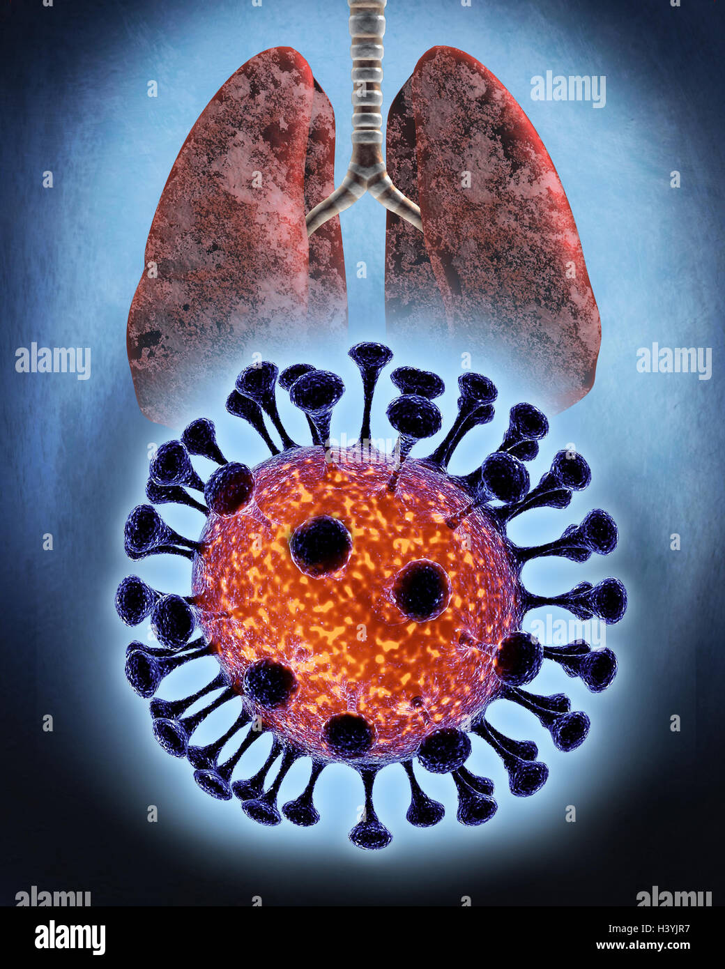 Coronavirus Infection Pathogen Sars Stockfotos & Coronavirus Infection ...