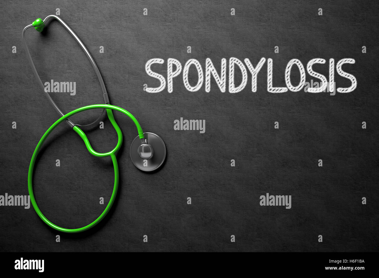 Spondylose an Tafel. 3D Illustration Stockfotografie - Alamy