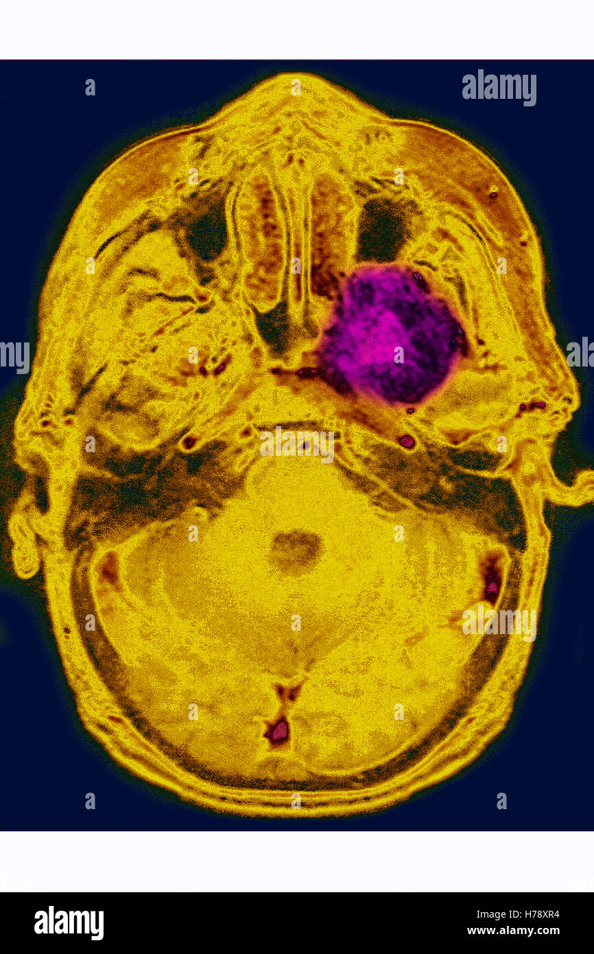 Cranial Nerves Stockfotos und -bilder Kaufen - Alamy