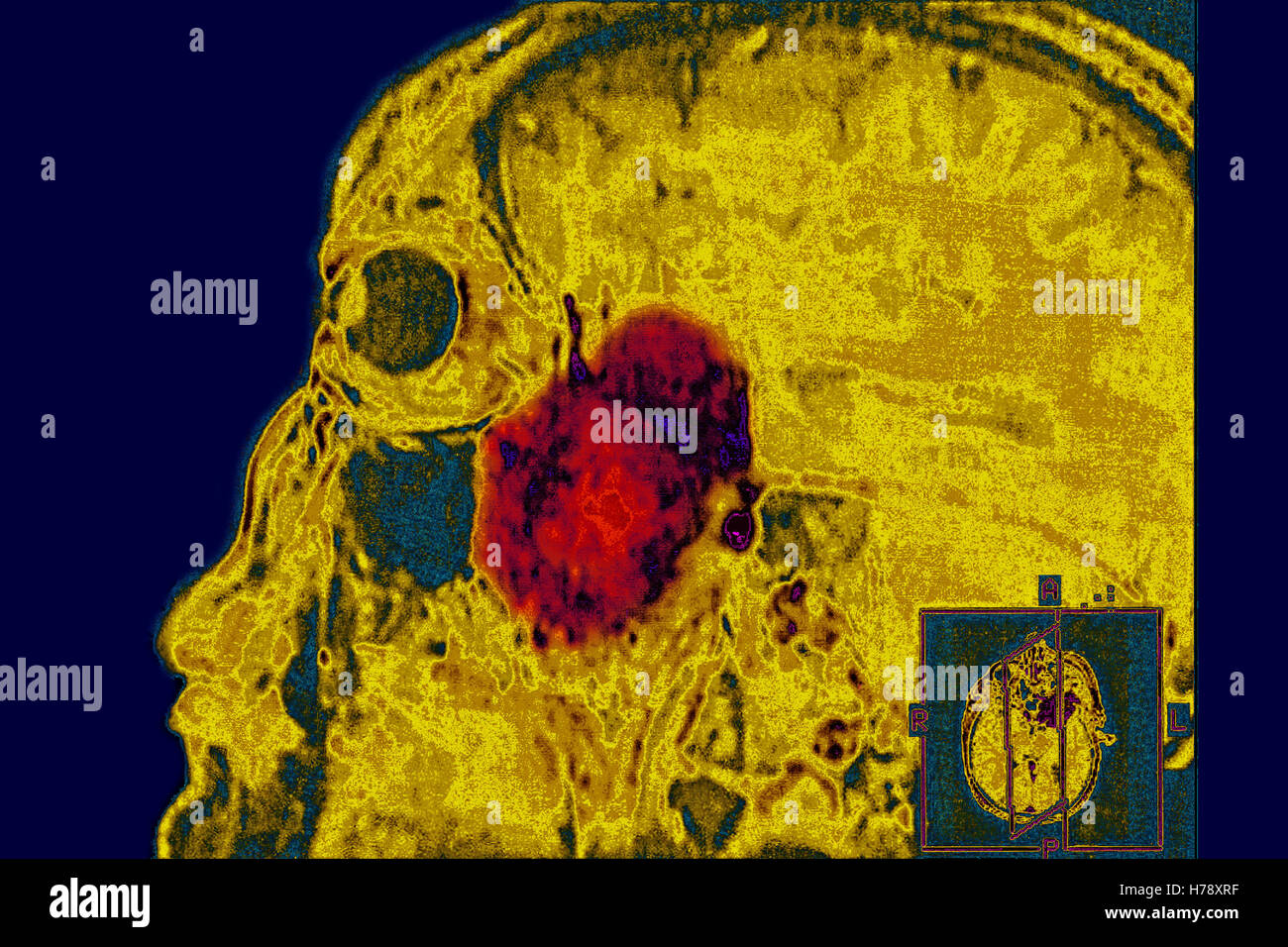 Cranial Nerves Stockfotos und -bilder Kaufen - Alamy