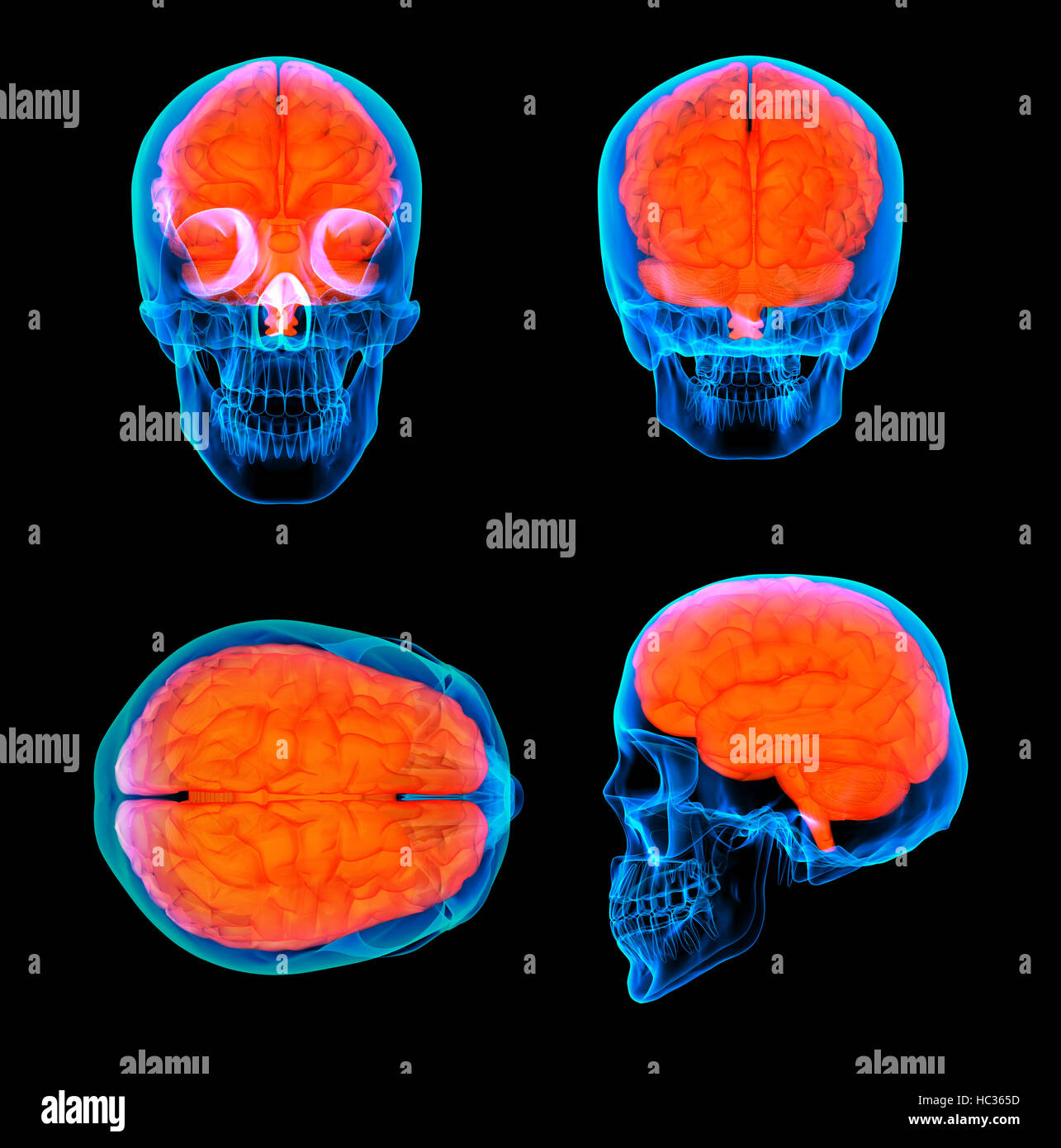 3D Render menschlichen rot brain X-ray Stockfotografie - Alamy