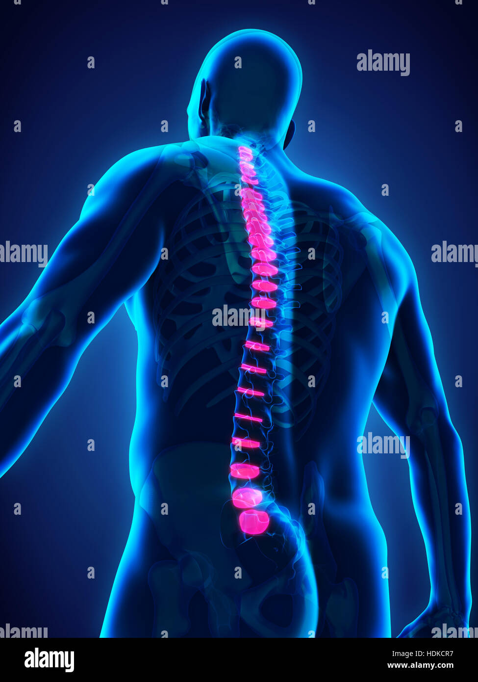 Wirbelsäule Bandscheibe Anatomie Stockfotografie - Alamy