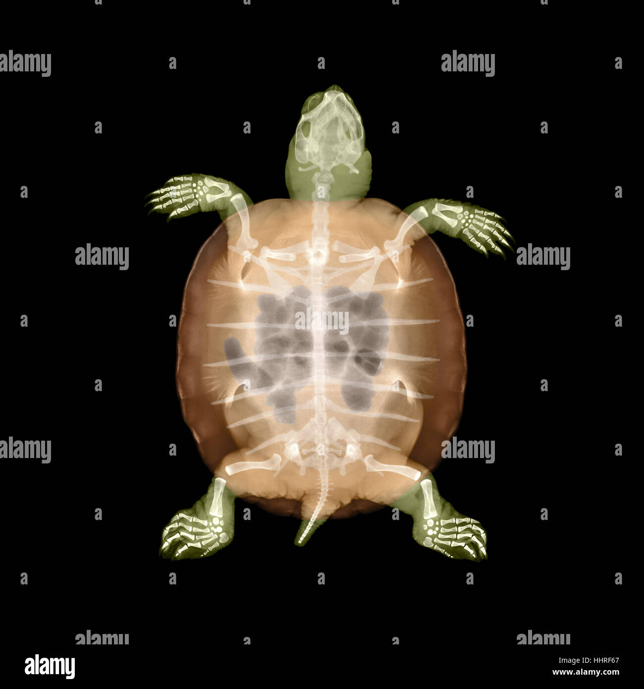 Baby xray -Fotos und -Bildmaterial in hoher Auflösung – Alamy