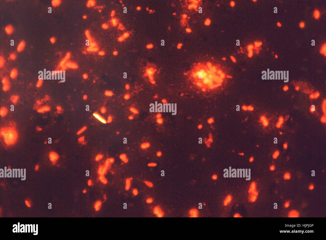Microscopia fluorescente bacterias -Fotos und -Bildmaterial in hoher ...