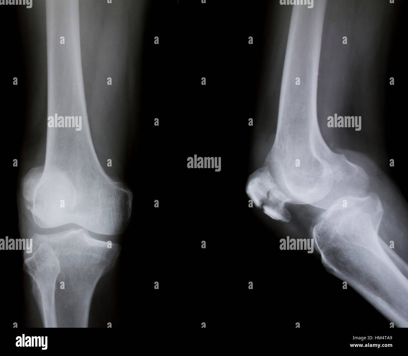 Normal neck x ray -Fotos und -Bildmaterial in hoher Auflösung – Alamy