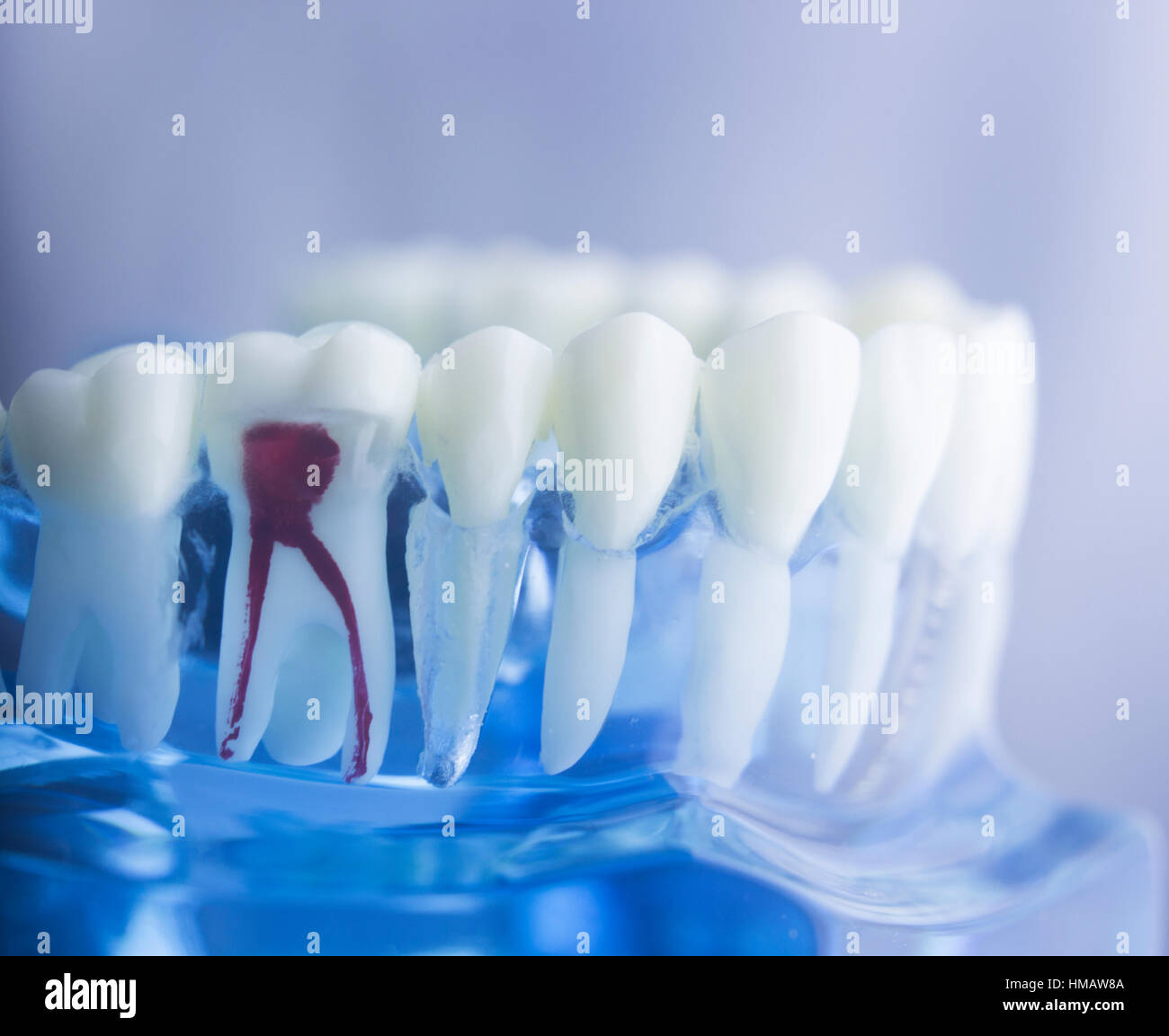 Dental Zahn Zahnmedizin Lernerfolge Lehrmodell zeigt Zähne, Wurzeln ...