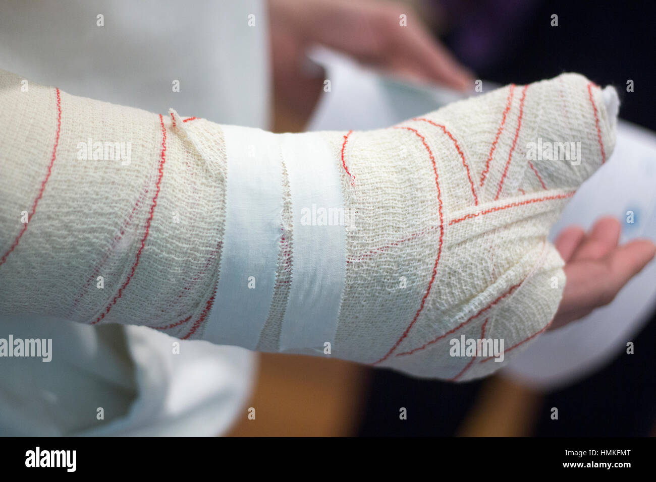 Arzt Patienten Unterarm und Handgelenk ein Gipsverband und Bandagen ...