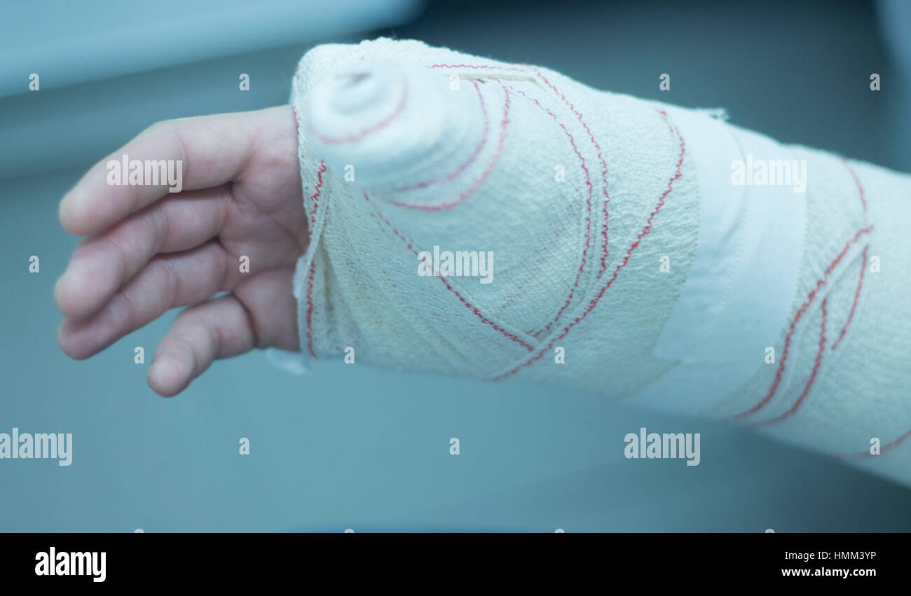 Arzt Patienten Unterarm und Handgelenk ein Gipsverband und Bandagen ...