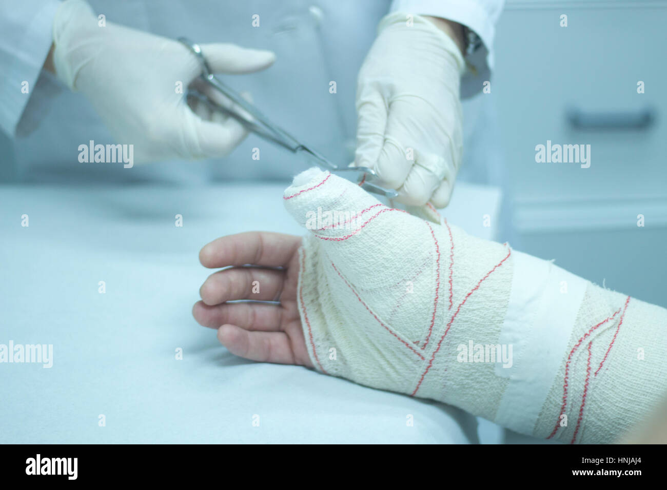 Arzt Patienten Unterarm und Handgelenk ein Gipsverband und Bandagen ...