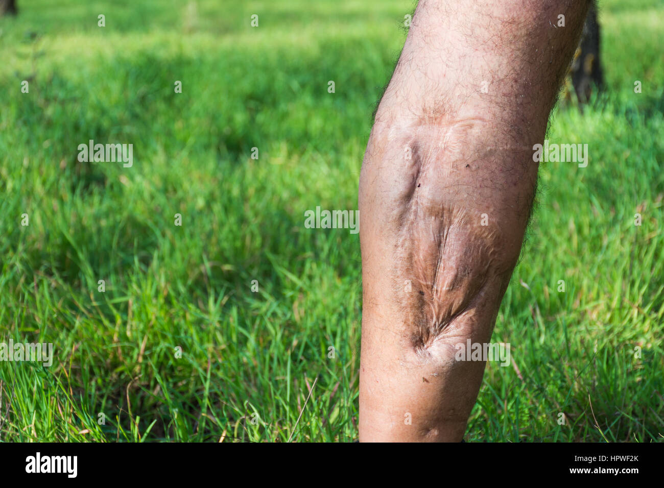 Unfall rekonstruktion -Fotos und -Bildmaterial in hoher Auflösung – Alamy