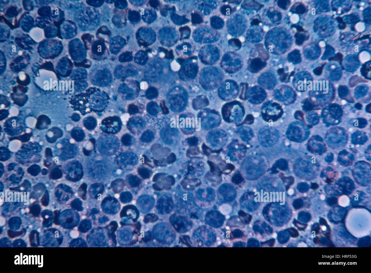 Bone light micrograph -Fotos und -Bildmaterial in hoher Auflösung – Alamy