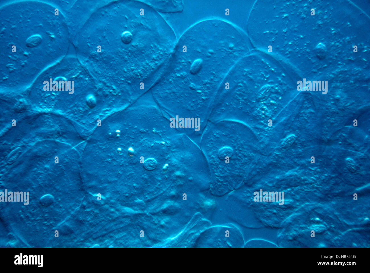 Epithelzellen Der Menschlichen Wange Stockfotos und -bilder Kaufen - Alamy