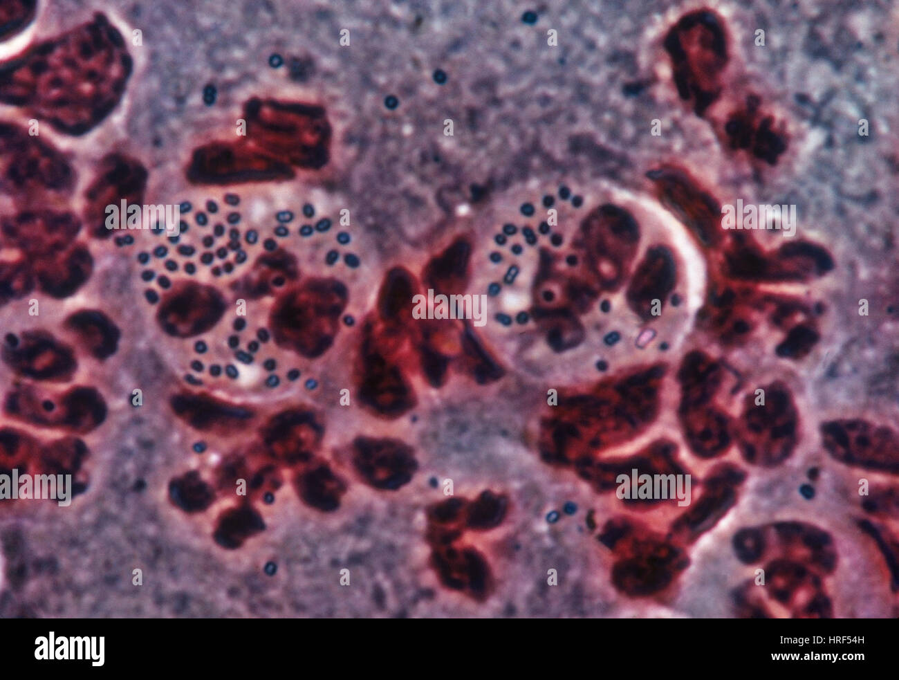 Neisseria Gonorrhoe (LM Stockfotografie - Alamy