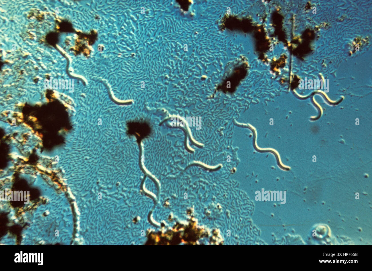 Spirilla bacteria -Fotos und -Bildmaterial in hoher Auflösung – Alamy