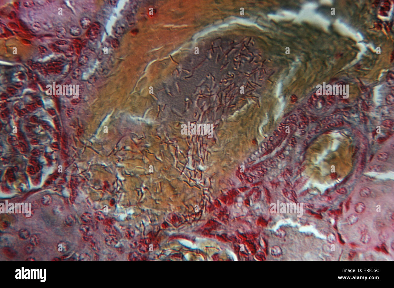 Anthrax bakterien terrorismus -Fotos und -Bildmaterial in hoher ...