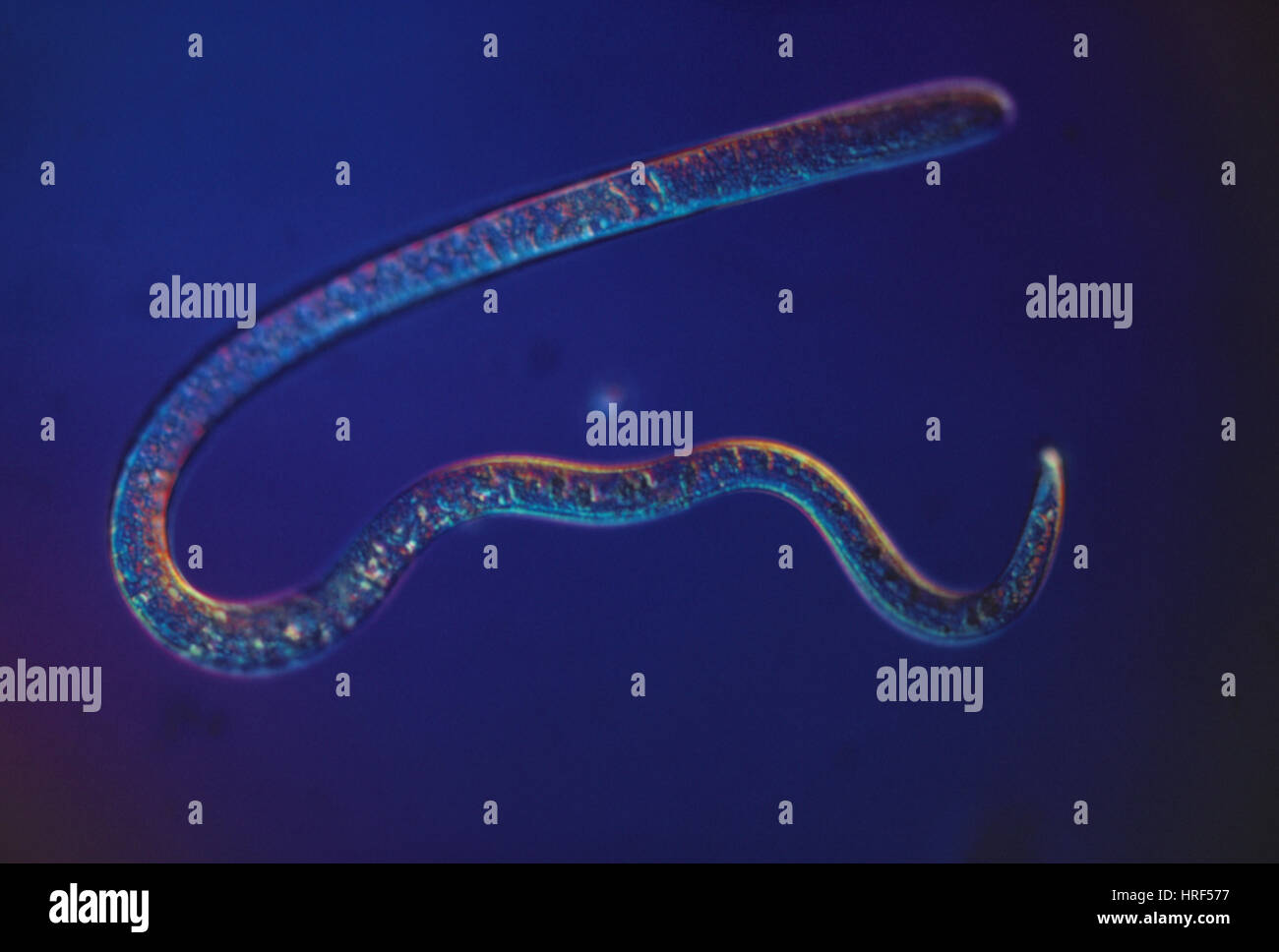 Trichinella spiralis -Fotos und -Bildmaterial in hoher Auflösung ...