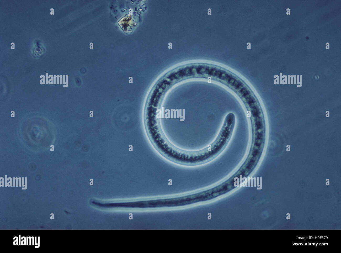 Trichinella sp -Fotos und -Bildmaterial in hoher Auflösung – Alamy