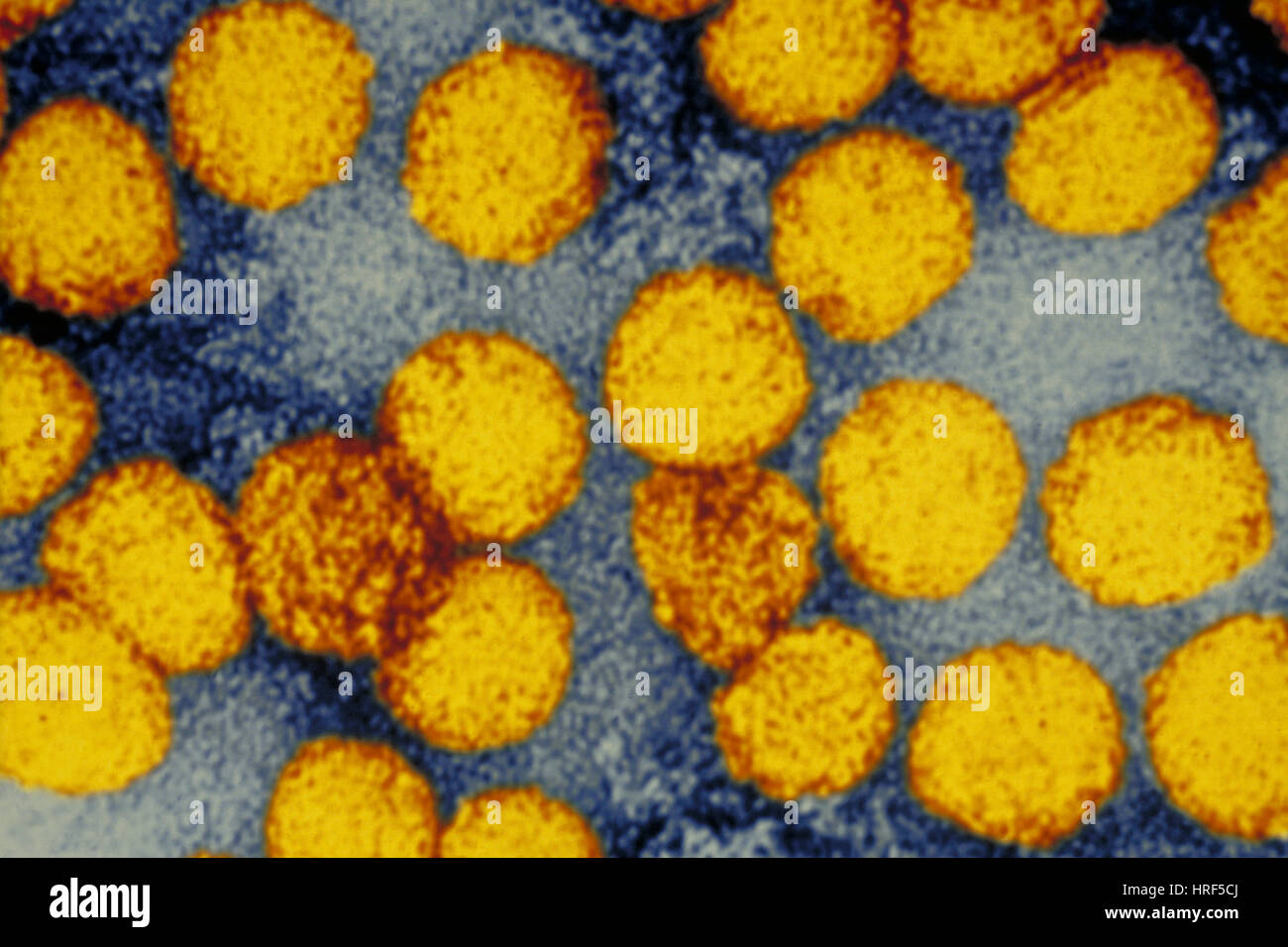 Yellow fever virus tem -Fotos und -Bildmaterial in hoher Auflösung – Alamy