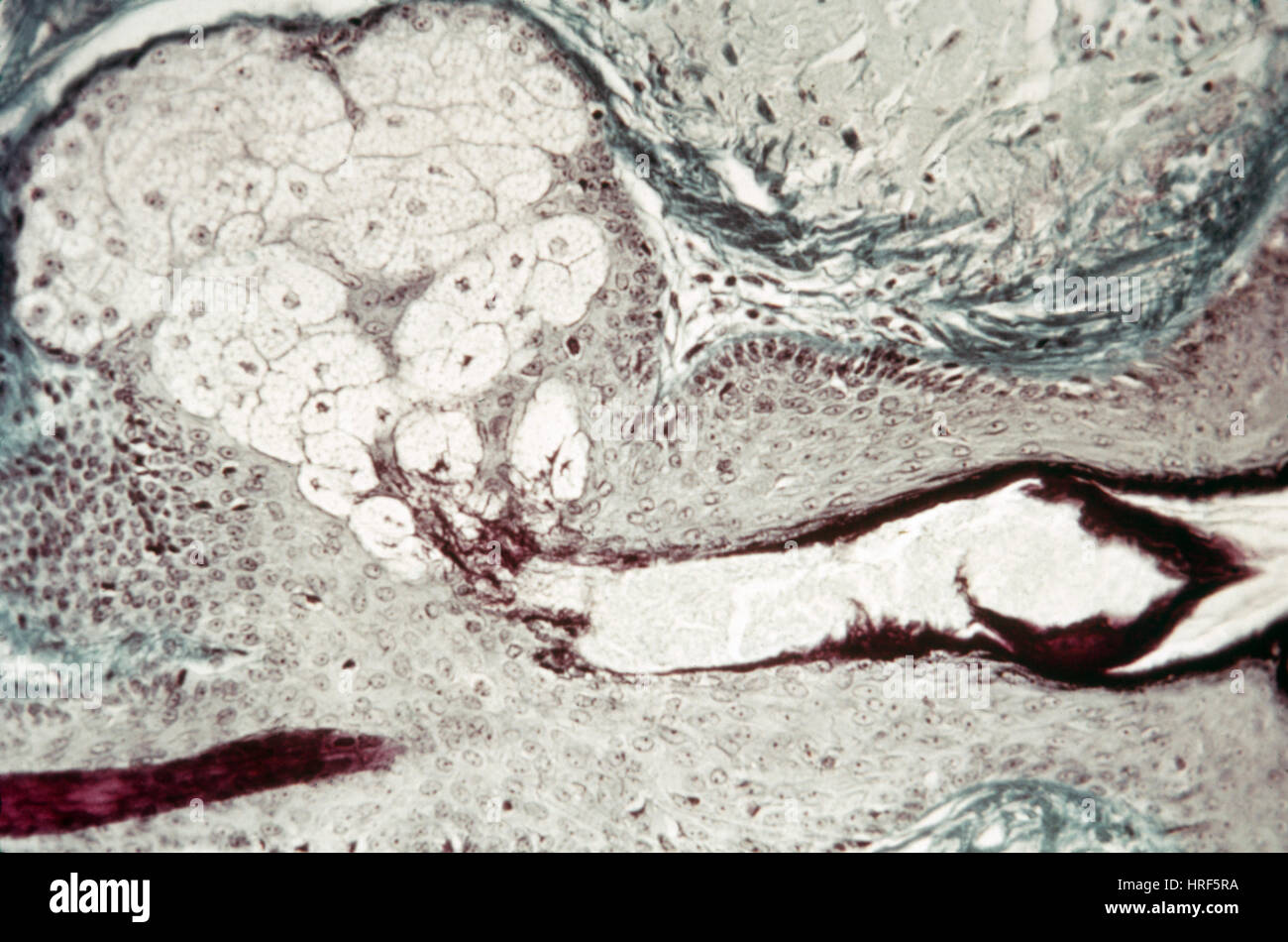 Sebaceous gland stain -Fotos und -Bildmaterial in hoher Auflösung – Alamy