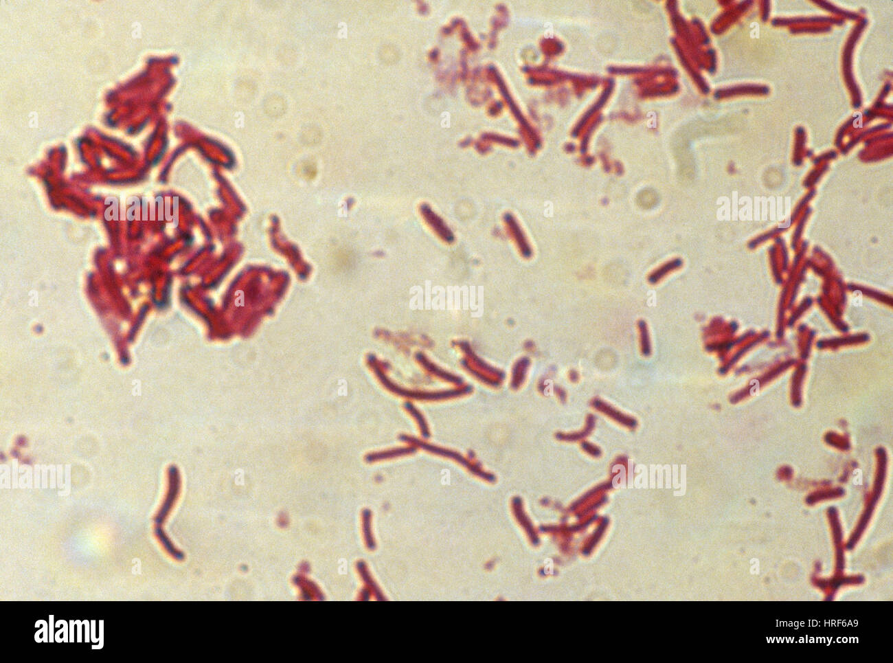 Clostridium perfringens bacteria -Fotos und -Bildmaterial in hoher ...